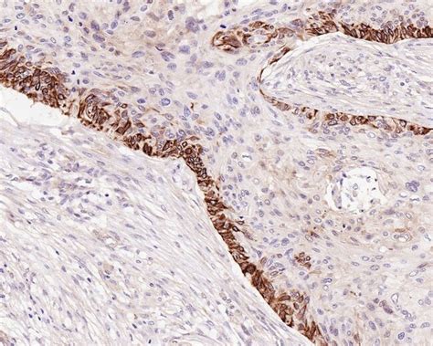 Bax Recombinant Rabbit Monoclonal Antibody Pd01 44 Invitrogen 100 μl