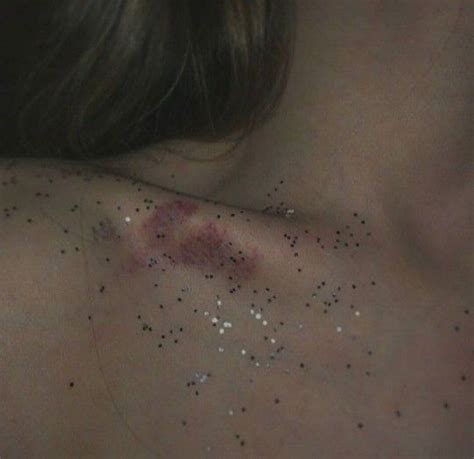 She Came Home Marked With Bruises And Glitter Bubbba