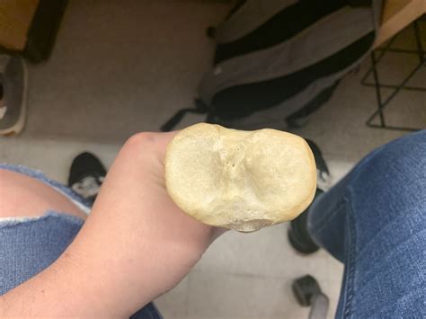 Tibia Superior Diagram Quizlet