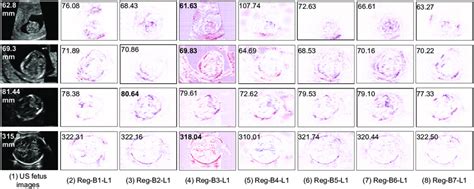 Saliency Maps Of Different Regression Cnns Explained By Lrp Method The Download Scientific