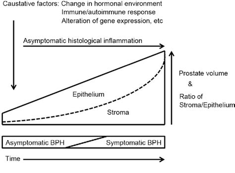 Figure 1 From The Influence Of Asymptomatic Inflammatory Prostatitis On The Onset And