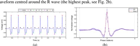 Processed Signal And Detected Peaks A Statistical Ecg Waveform B Download Scientific Diagram