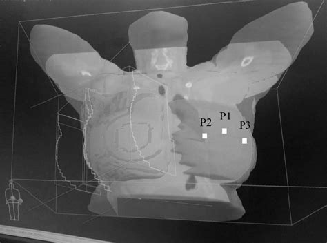 The Position Of Diode Detector On Patients Skin Of The Contralateral Download Scientific The Position Of Diode Detector On Patients Skin Of The Contralateral Download Scientific