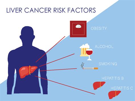 Liver Cancer Awareness Month What Are The Risk Factors Golden State