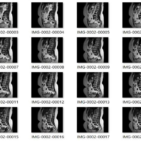sample sci database with disease type abnormal and normal cases of