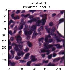 Colorectal Histology Mnist Maria Zorkaltseva S Tech Blog