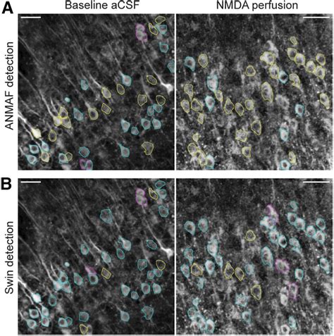 A Deep Learning Approach For Neuronal Cell Body Segmentation In Neurons Expressing Gcamp Using A
