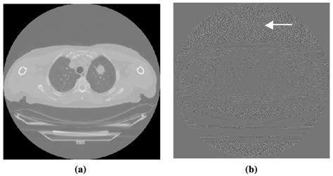 Noise Suppression After Adaptive Filtering A Is The Clean Download Scientific Diagram