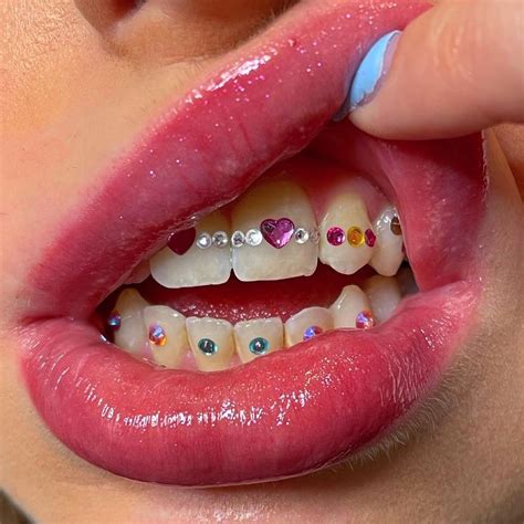 Pin Em Details Ideias Para Piercings Grills Dentes Jóias Com Diamantes