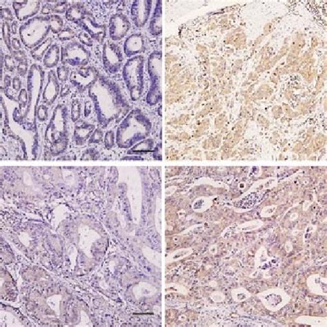 Immunohistochemical Staining Of Crm1 And Cdk5 Expression In Gastric Download Scientific Diagram