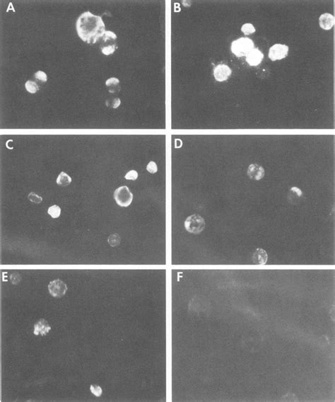 Immunofluorescence Staining Patterns With R3 And K8 Monoclonal Download Scientific Diagram
