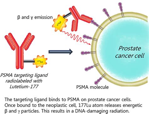 Frontiers New Prostate Cancer Targets For Diagnosis Imaging And Therapy Focus On Prostate