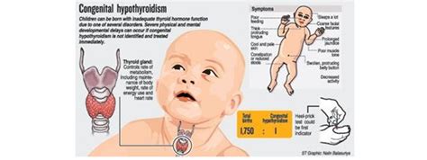 Congenital Hypothyroidism Adults