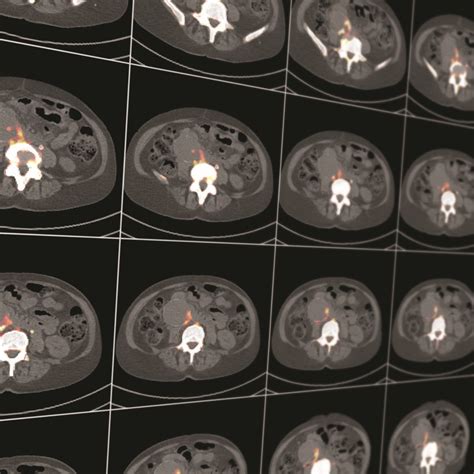 Synergistic Tomographic Image Reconstruction Royal Society