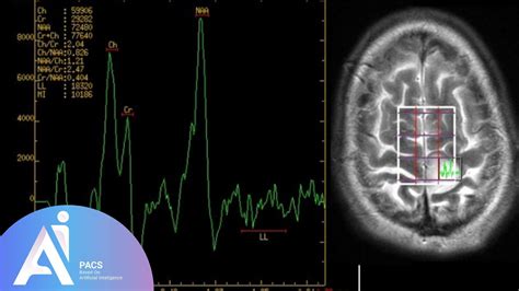 Everything About Mr Spectroscopy