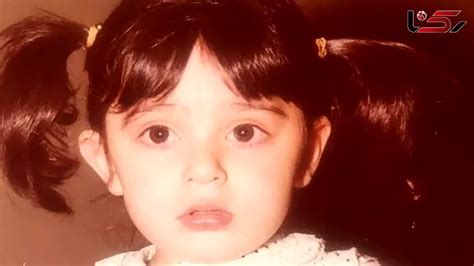 دختر چشم درشت کدام خانم بازیگر جذاب است عکس قبل و بعد عمل زیبایی