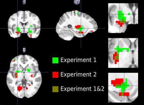 Figure Supplement 2 Overlaying Prediction Error Associated Responses