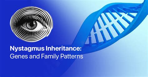 Downbeat Nystagmus Understanding This Unique Eye Movement Disorder Dr Astrid Larsen