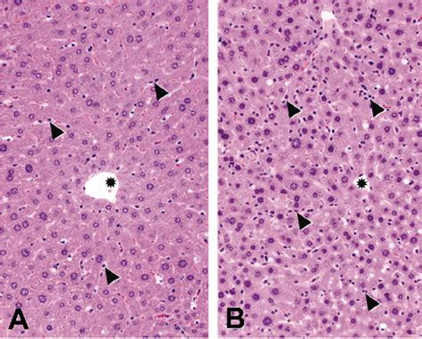 Figure 1 From Pregabalin Induces Hepatic Hypoxia And Increases Endothelial Cell Proliferation In
