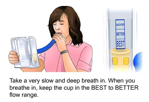 Using Your Incentive Spirometer Eras