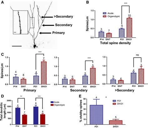 Dendrite Classification And Spine Analysis Of Gcs From Acute And
