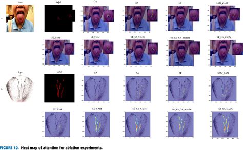 Figure 10 From Cracked Tongue Extraction Model Based On Improved U Net Method Semantic Scholar