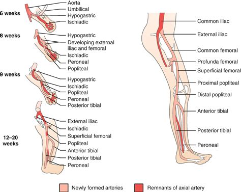 Nonatheromatous Popliteal Artery Disease Clinical Tree