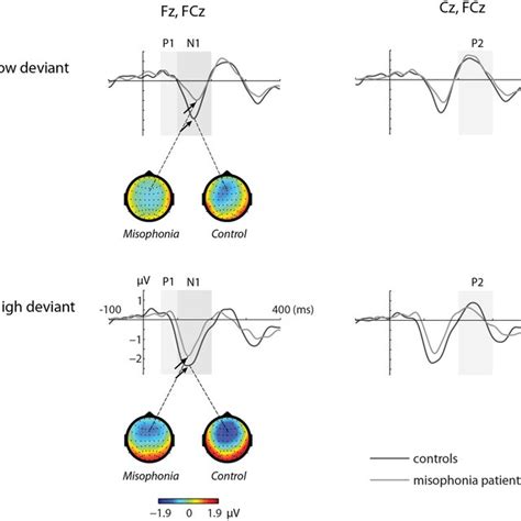 The Grand Average Erp Waveforms Of Controls N 14 And Misophonia