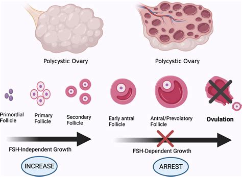 Figure From The Polycystic Ovary Syndrome What Is It What 43 Off