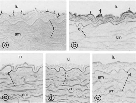 Fig La E Light Micrographs Of Semithin Sections Of Rabbit Aorta Download Scientific Diagram