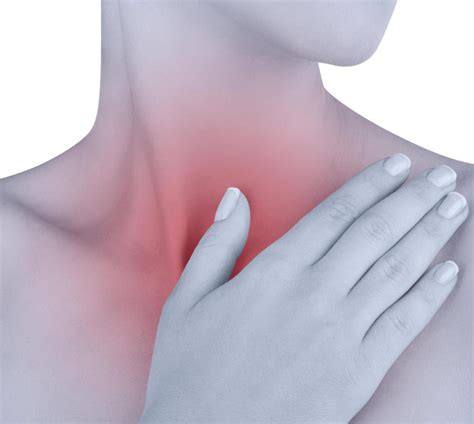 Acid Reflux White Tongue Sore Throat Zucnys