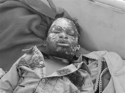 Three Siblings Got Burnt In A Firecracker Explosion In Bhiwari पटाखों में विस्फोट से तीन भाई