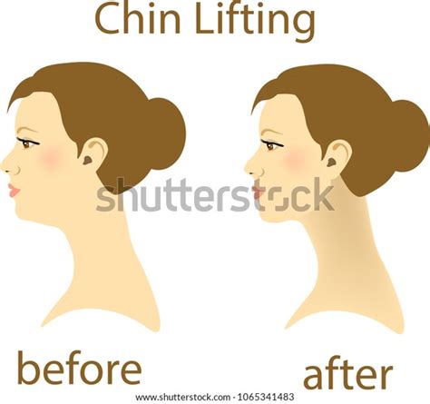 Illustration Woman Double Chin Normal Chin Stock Vector Royalty Free 1065341483