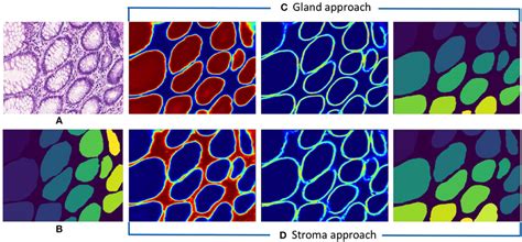 segmentation results for colon adenocarcinoma dataset a original