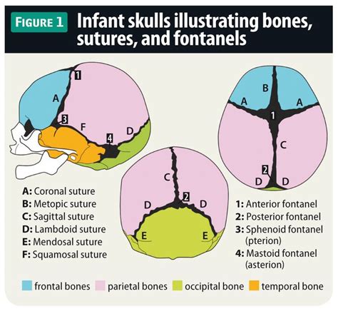 Evaluating Fontanels In The Newborn Skull Pediatric Nursing Physician Assistant School