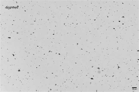 Mixture Of Lung Cancer And Glioblastoma Ffpe Tissues Dissociated Manually Or Using Gentlemacs