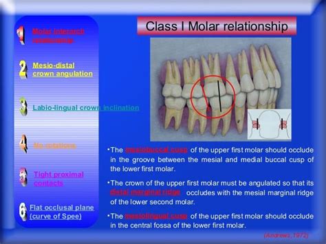 andrews six keys of occlusion