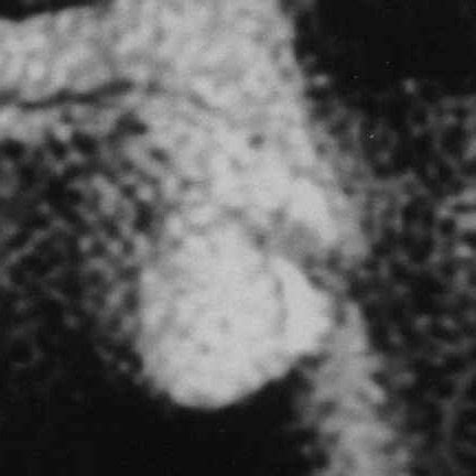 Pdf Magnetic Resonance Imaging Of Sexual Intercourse Initial Experience