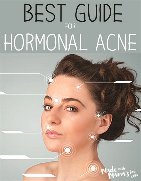 How To Get Rid Of Hormonal Acne Naturally Reliably A 7 Step Plan For