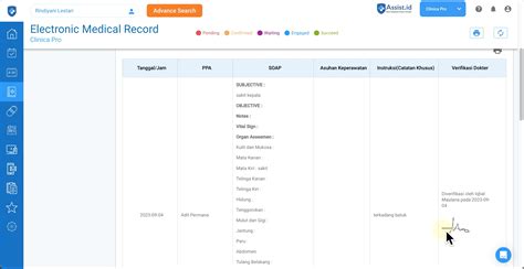 Cara Menggunakan Fitur Cppt