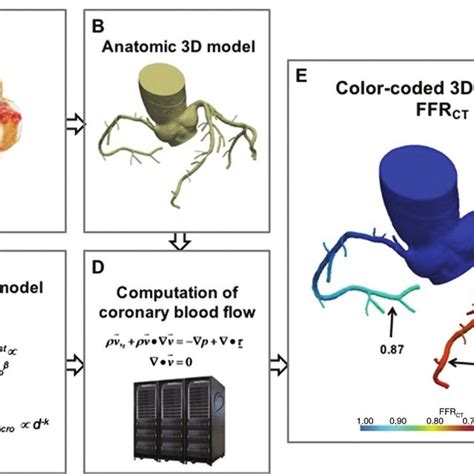 determination of ffr ct by using computational fluid dynamics