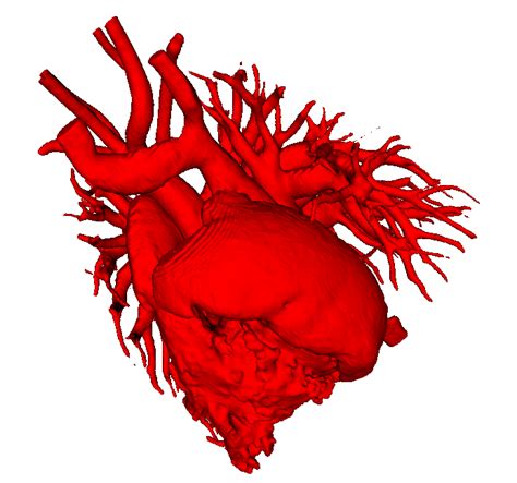 Comparison Of A Manual Segmentation And B Unetimplicit Network Download Scientific Diagram