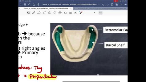 Anatomy Of Edentulous Mandible Youtube