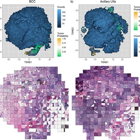 Clinical Grade Computational Pathology Using Weakly Supervised Deep