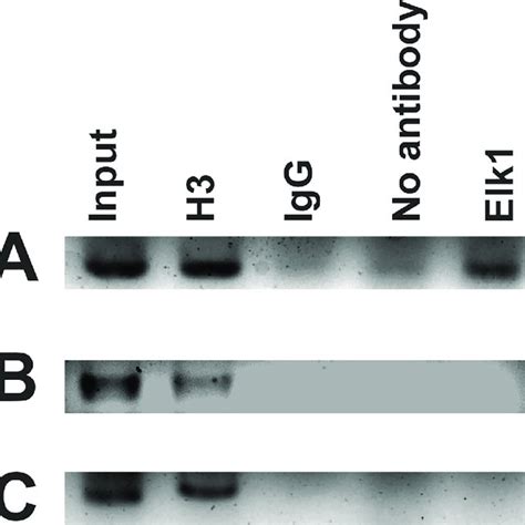 Pcr Results Of Chip Assay Chip Assay Was Performed With Sh Sy5y Cells Download Scientific Pcr Results Of Chip Assay Chip Assay Was Performed With Sh Sy5y Cells Download Scientific