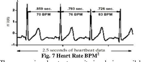 figure 1 from abnormal driver behavior detection using parallel cpu and