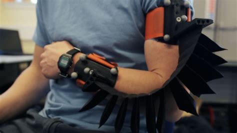 Aberdeens Soft Robotic Arm Could Help People Recovering From Stroke