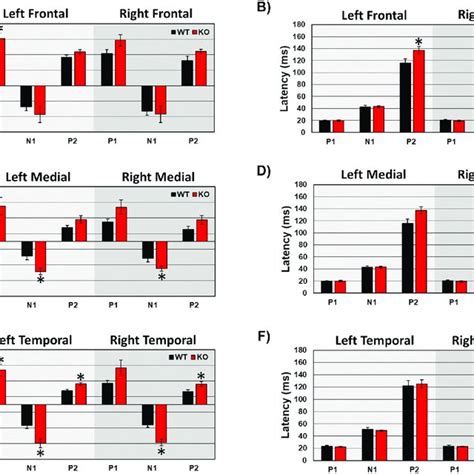 Quantitation Of Auditory Event Related Potential Erp Amplitudes And Download Scientific