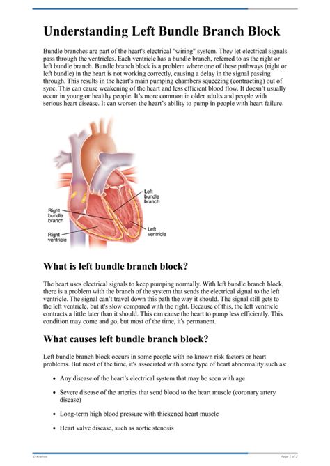 Text Understanding Left Bundle Branch Block HealthClips Online