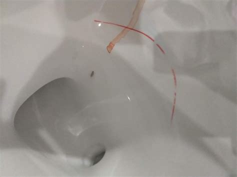 Ceramic Defect Detection Roboflow Universe